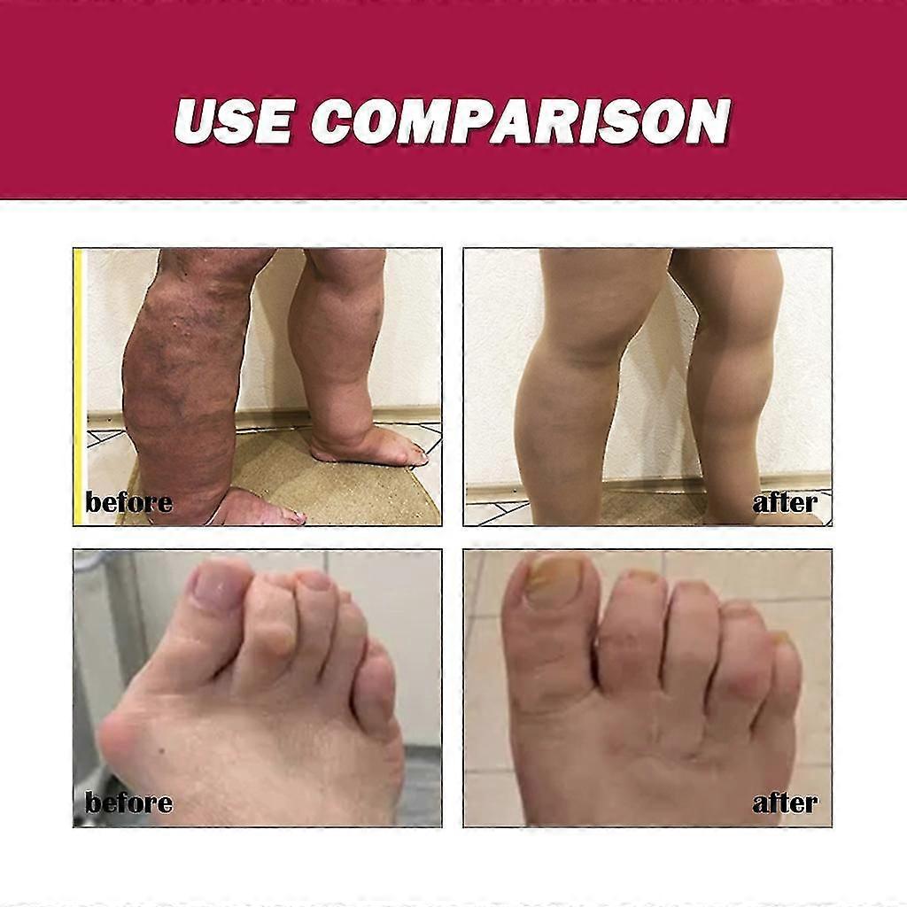 1 Oz Joint Bone Therapy-intensive Concentrate Cream For Back,neck,hands ...