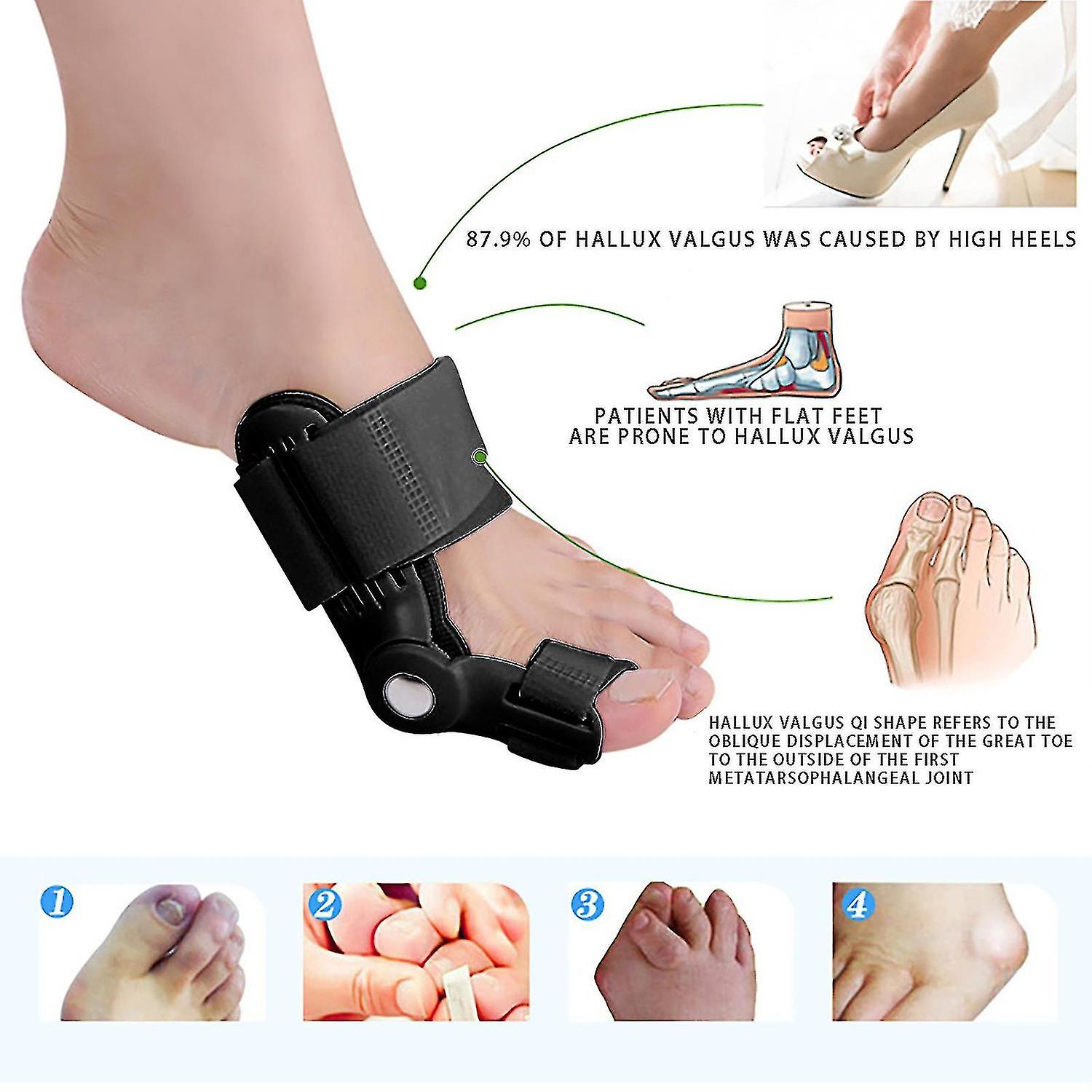 Hallux Valgus Splint Valgus Correction Hallux Valgus Toe Separator ...