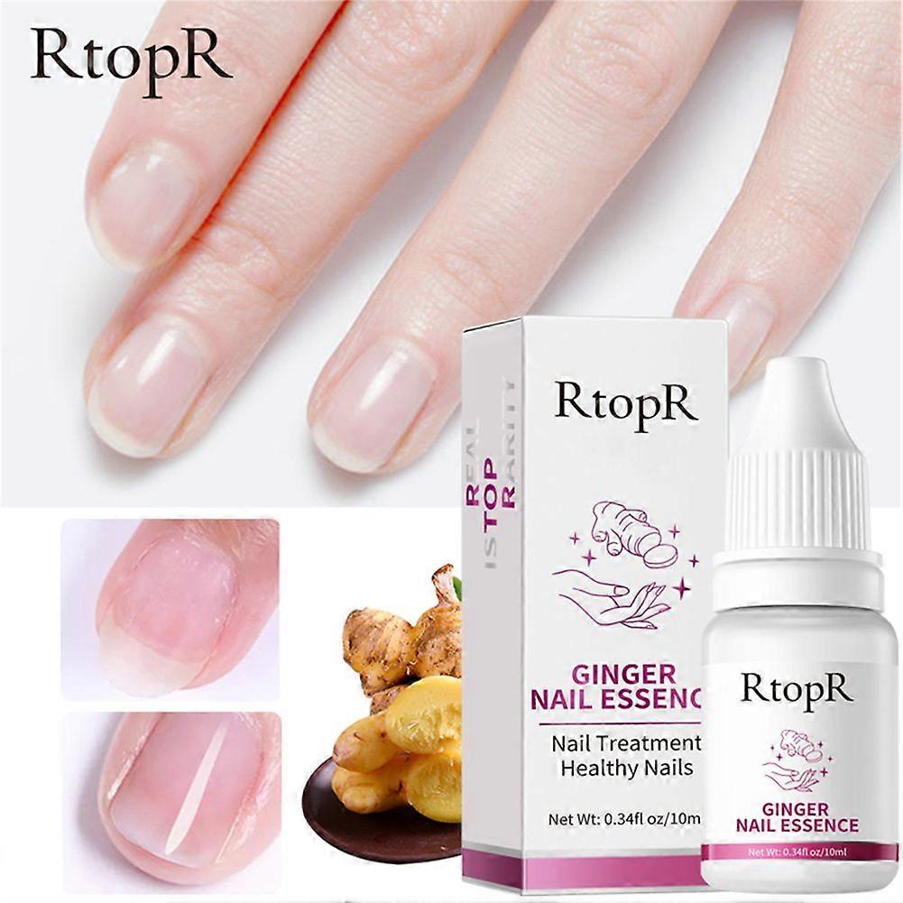 RtopR Ginger nail polish Nail Treatment Fungal Nail Repair Rough nail ...
