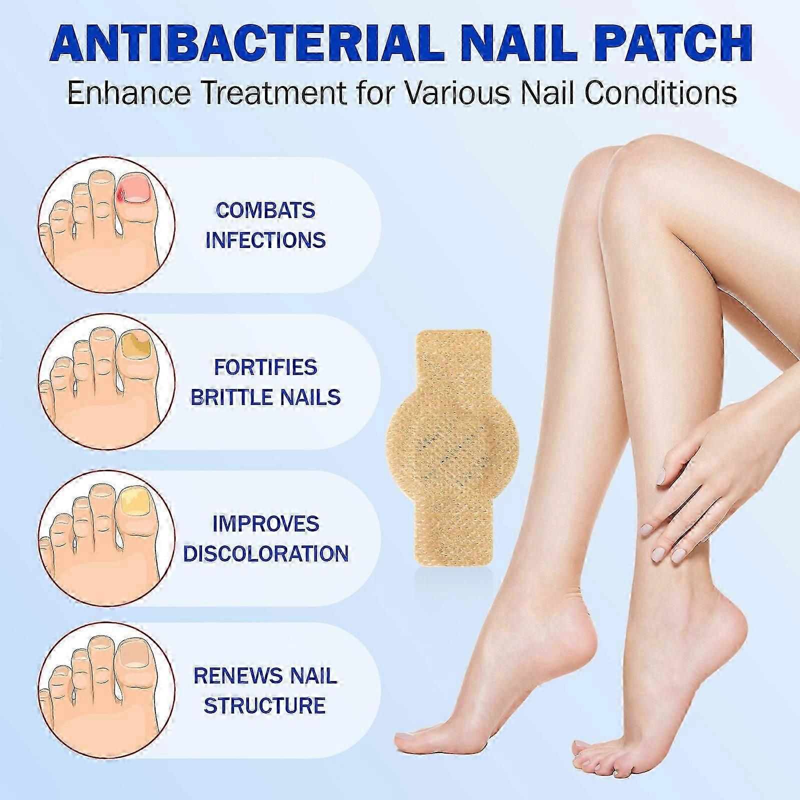 Oenail Fungus Patch Waterproof Nail Repair Patches Nail Ingrown ...