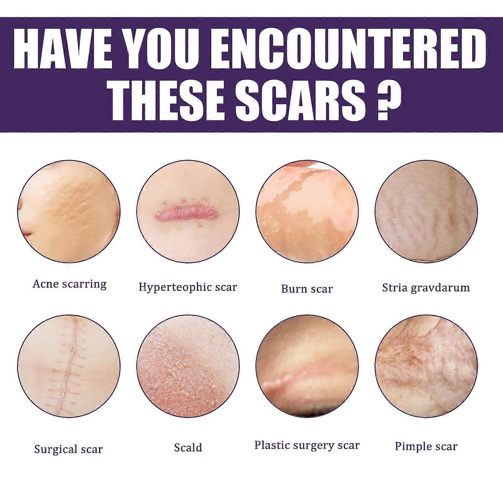 Self-Adhesive Silicone Gel Scar Patch Waterproof Professional Scar ...