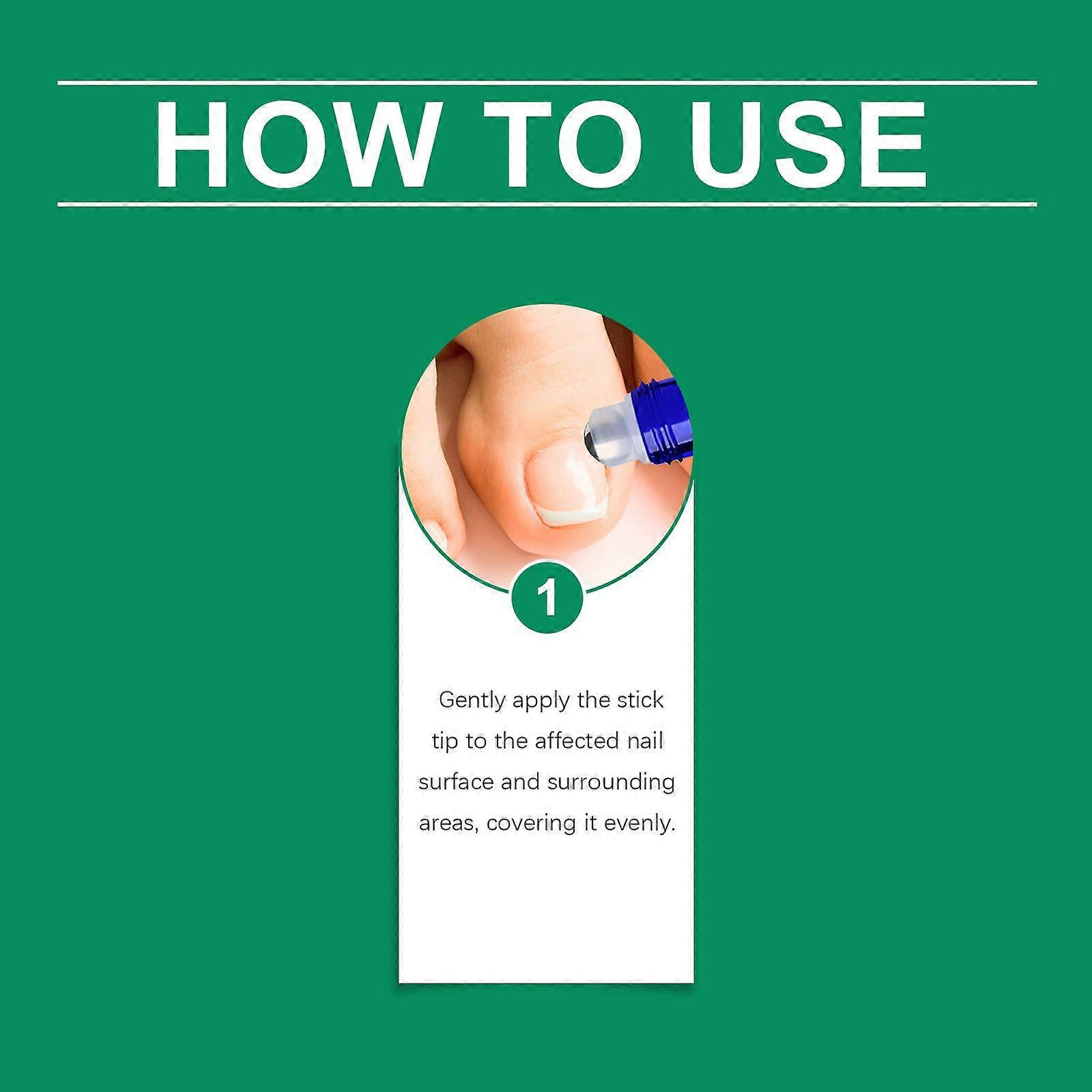 Anti-Fungal Stick, Nail Care Roller for Fungal Nail Infections Quickly ...