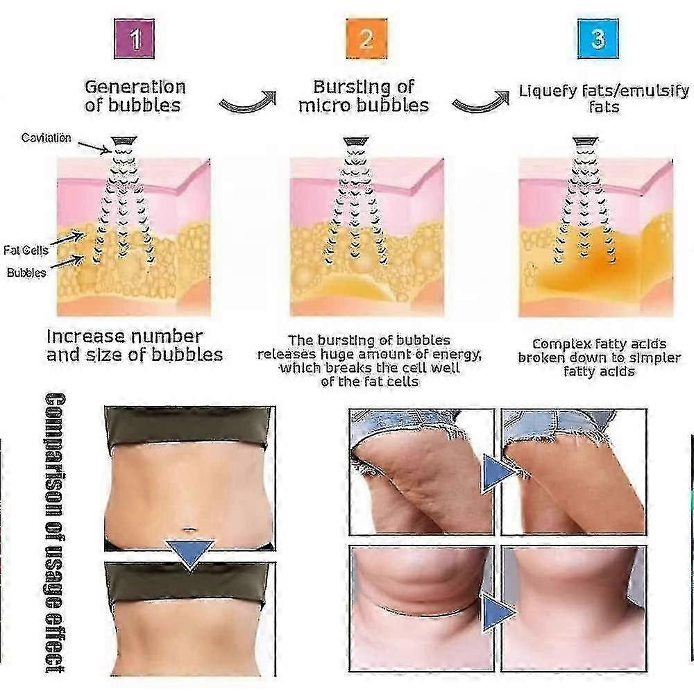 Lymph Drainage Magnetic Bracelet - Ultrasonic High-tech Body Shape Wristband | Fruugo UK