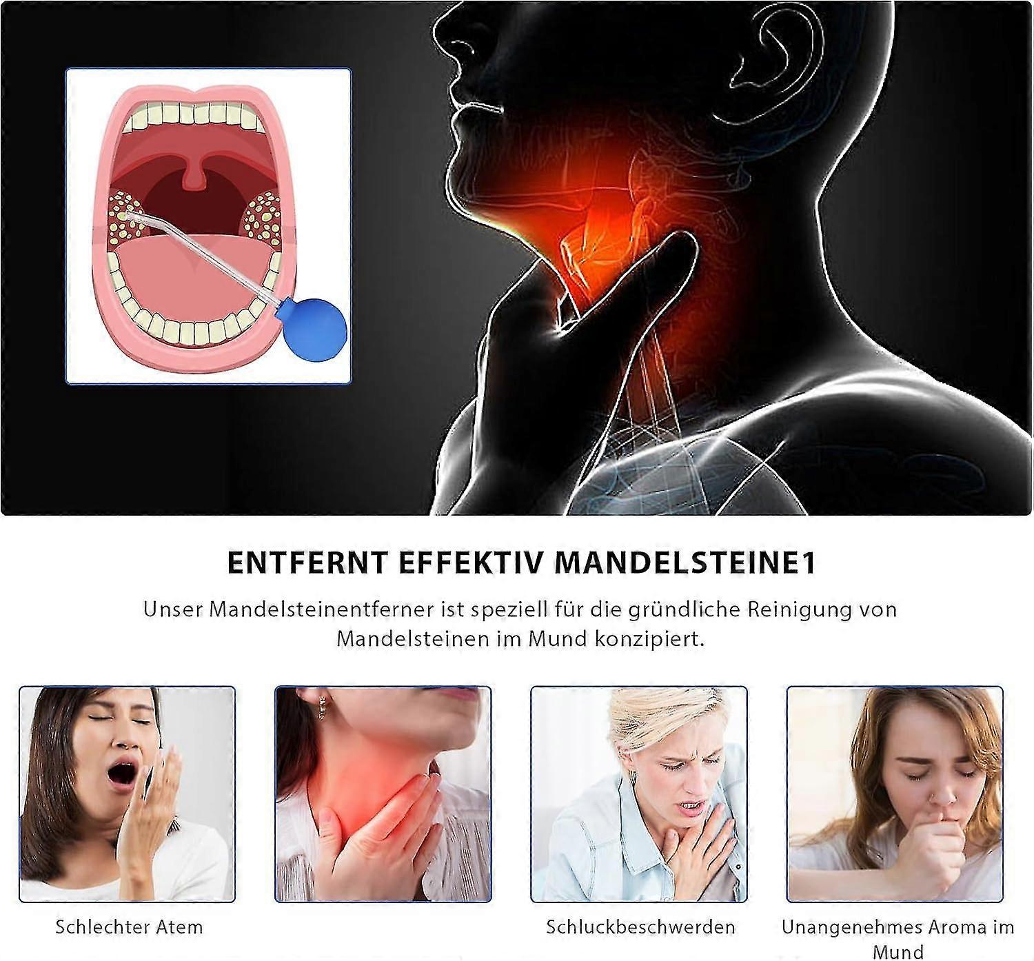 Tonsil Stone Remover, Tonsil Stone Removal Kit, Amandel Stenen Cupping ...