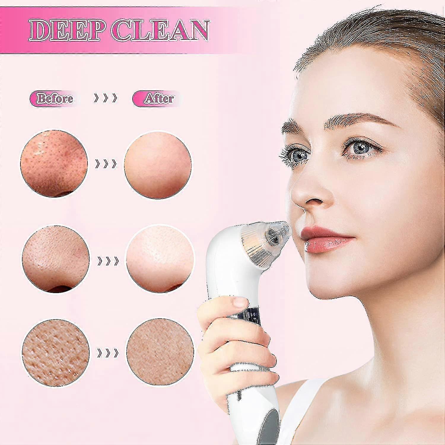 Blackhead Remover Vacuum, Face Suction Pore Cleanser, Pore Vacuum With ...