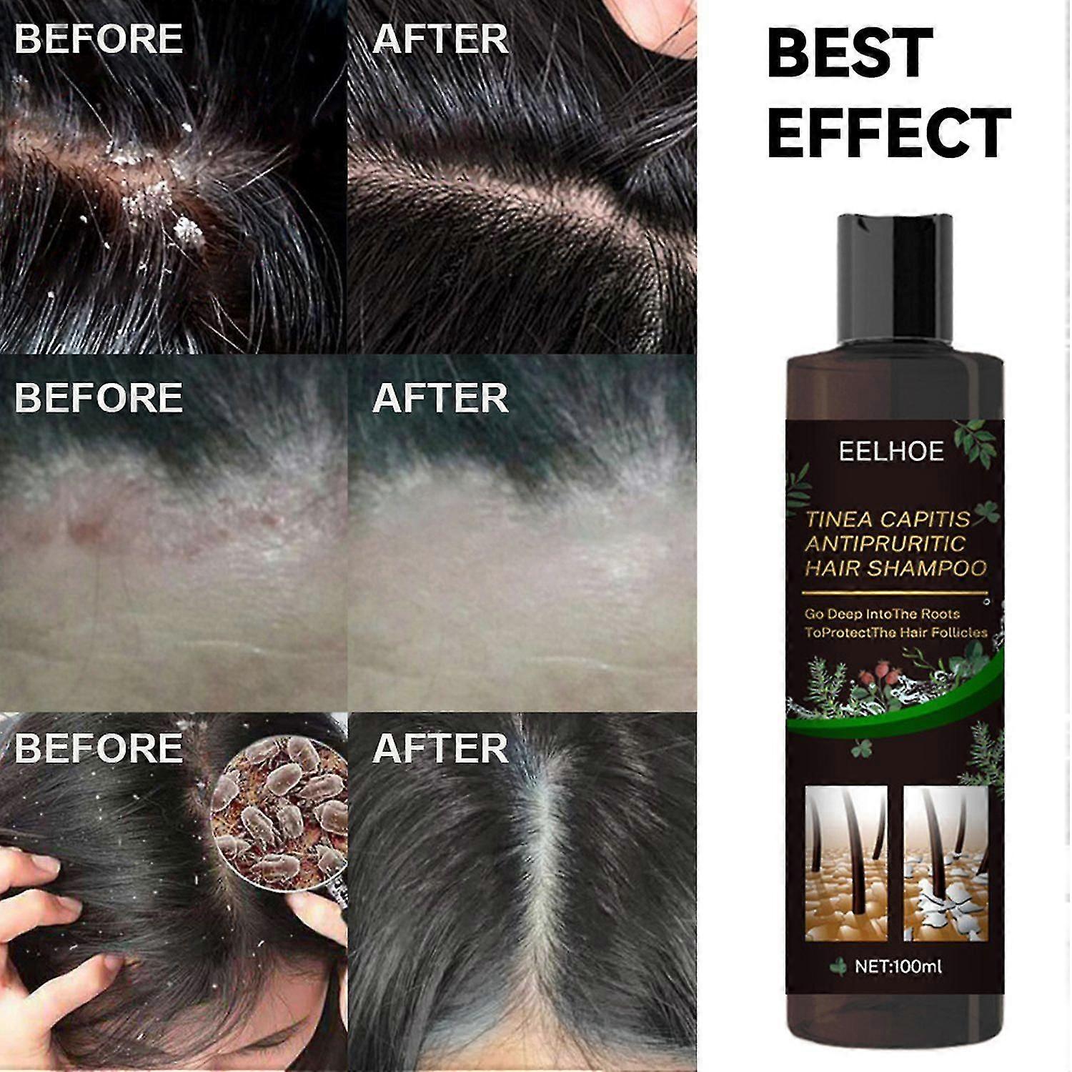 100ml Hair Shampoo Foam Rich Oil Control Hair Care Anti-dandruff Anti-itch Shampoo for Men Women ...