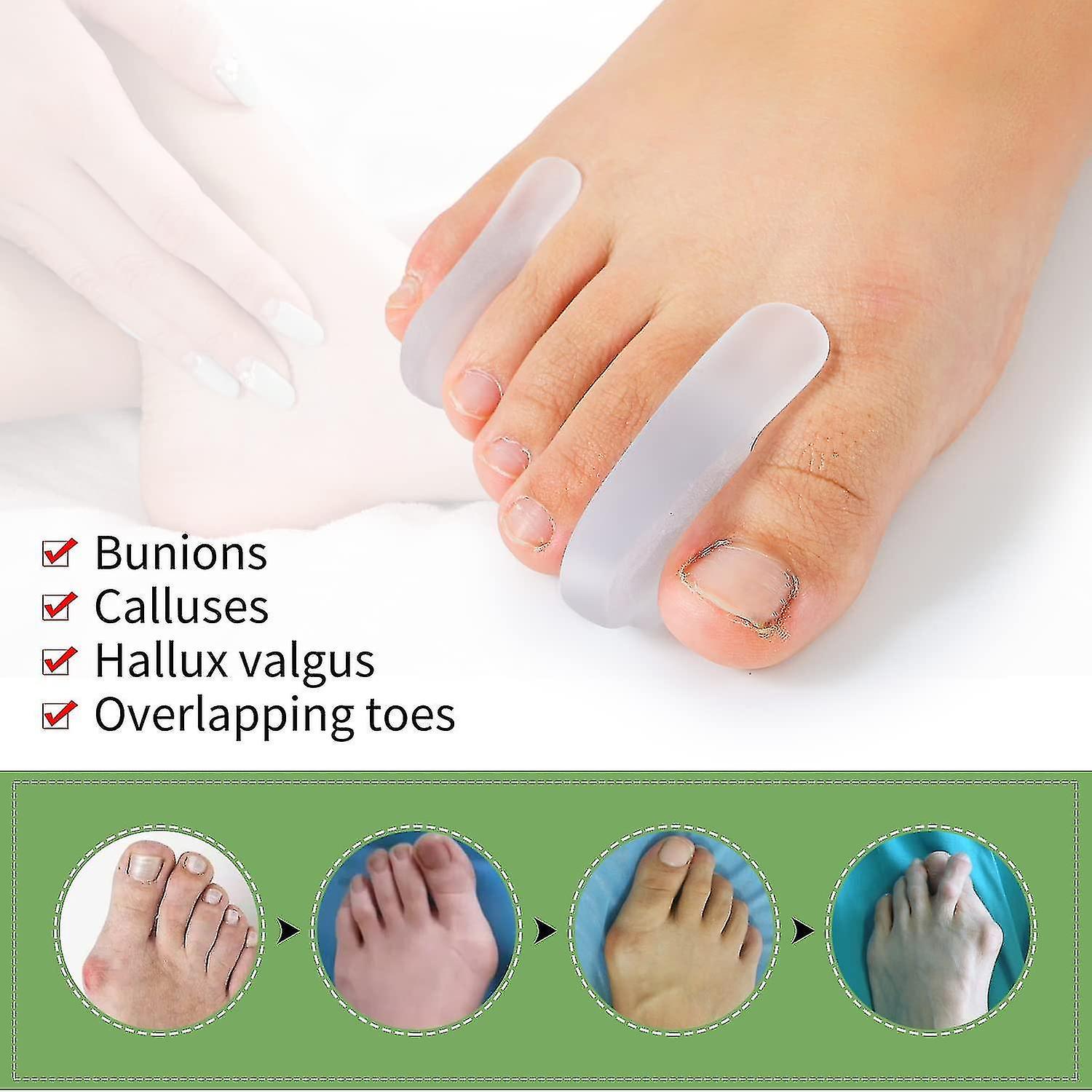Gel toe spacers for toe alignment spreaders reusable big toe dividers ...
