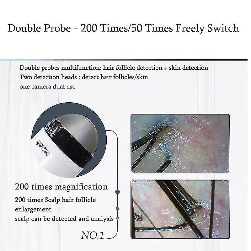 Wifi Hd 5g Scalp/skin /hair Follicle Detector Professional 50x/200x ...