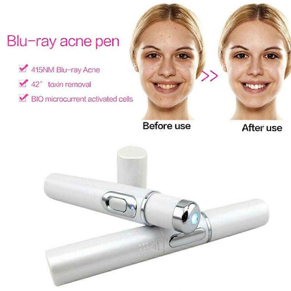 Blue Light Therapy Pen for Acne Spider Veins Scar Removal Dark Circles ...