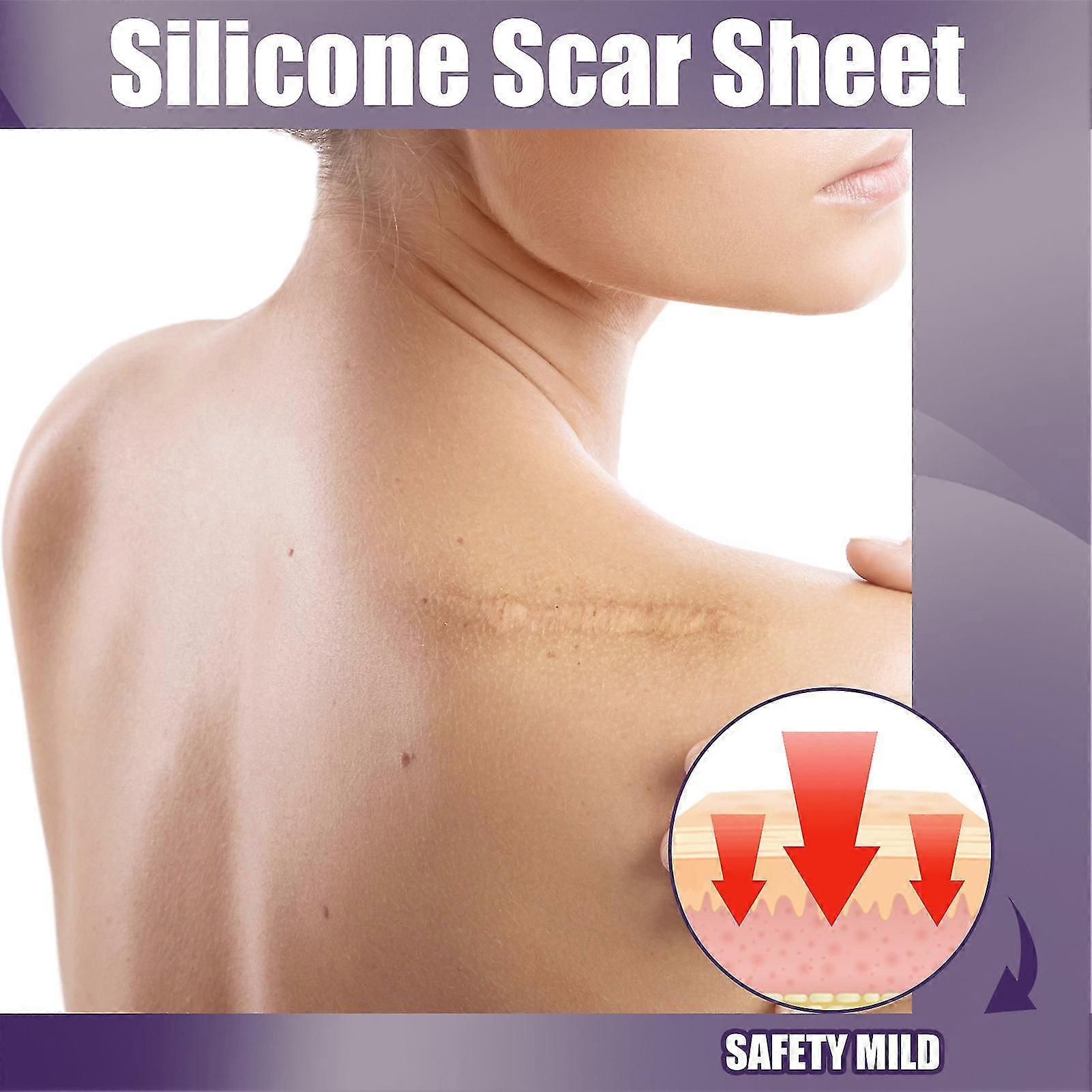 8 Pcs Silicone Scar Sheets Safety Mild Odorless Comfortable Fade Scars ...