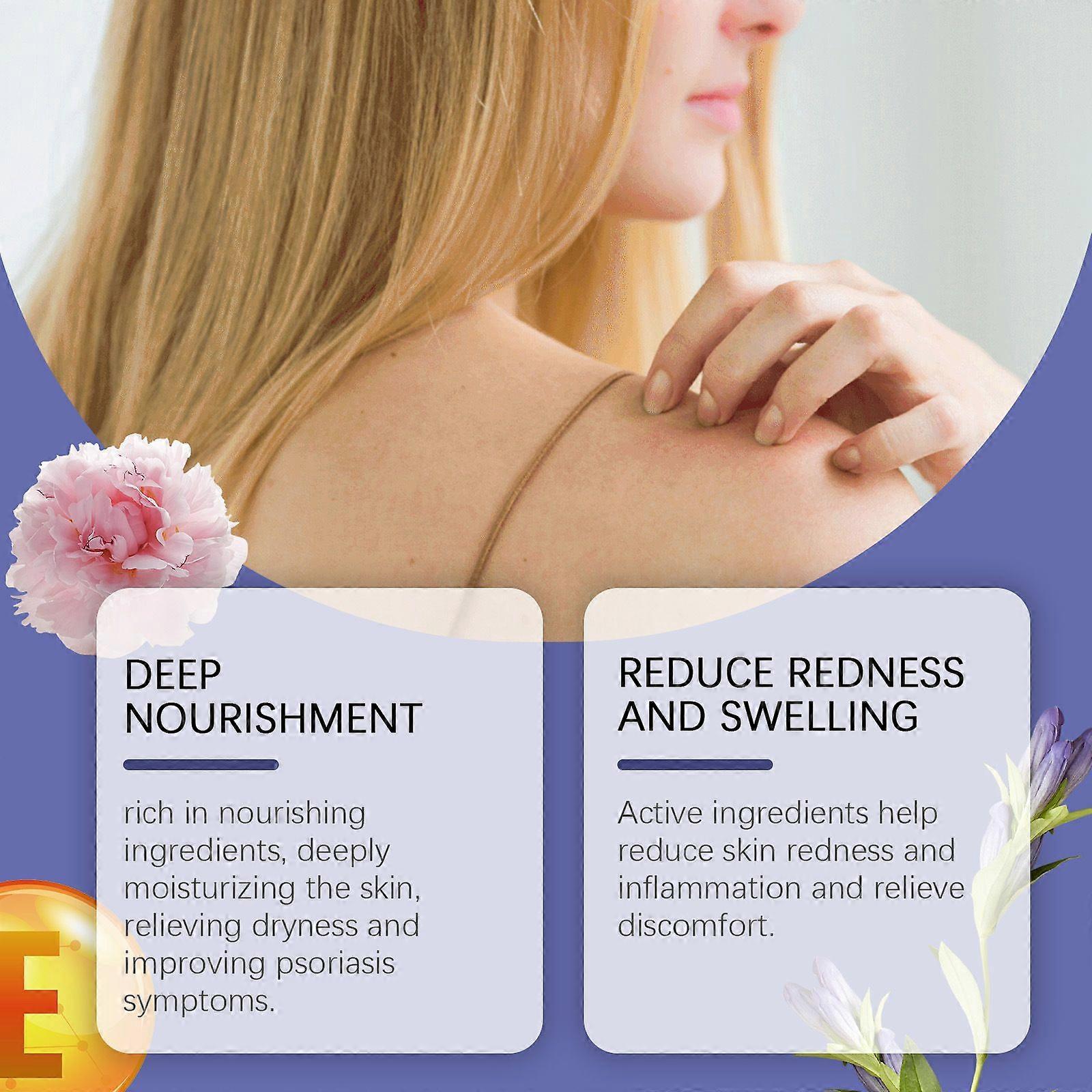 Psoriasis Relief Cream - Anti-itch Lotion for Psoriasis - Itch Relief ...