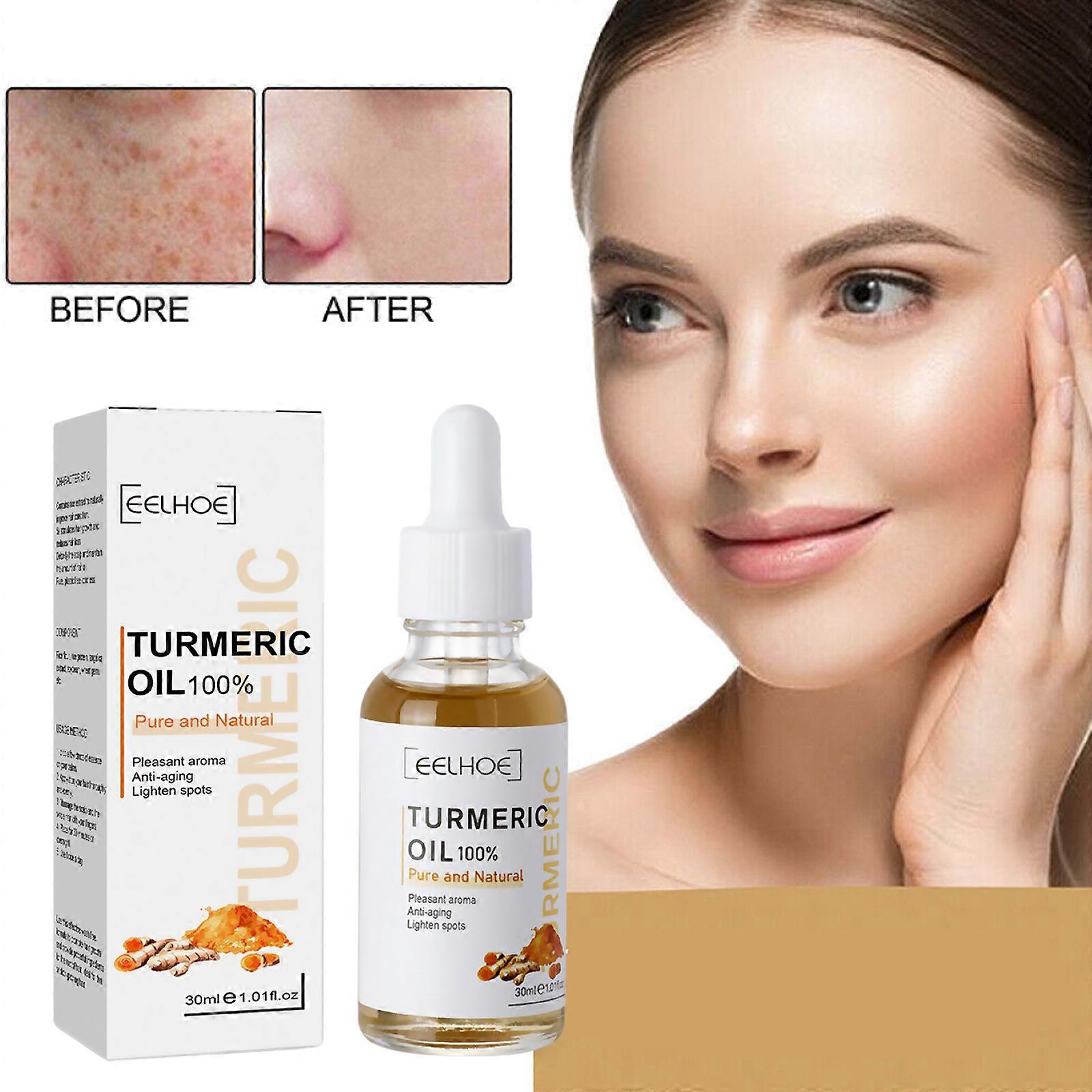 Turmeric Cream Dark Spot Corrector Skin Melasma Remove Wrinkles Serum ...