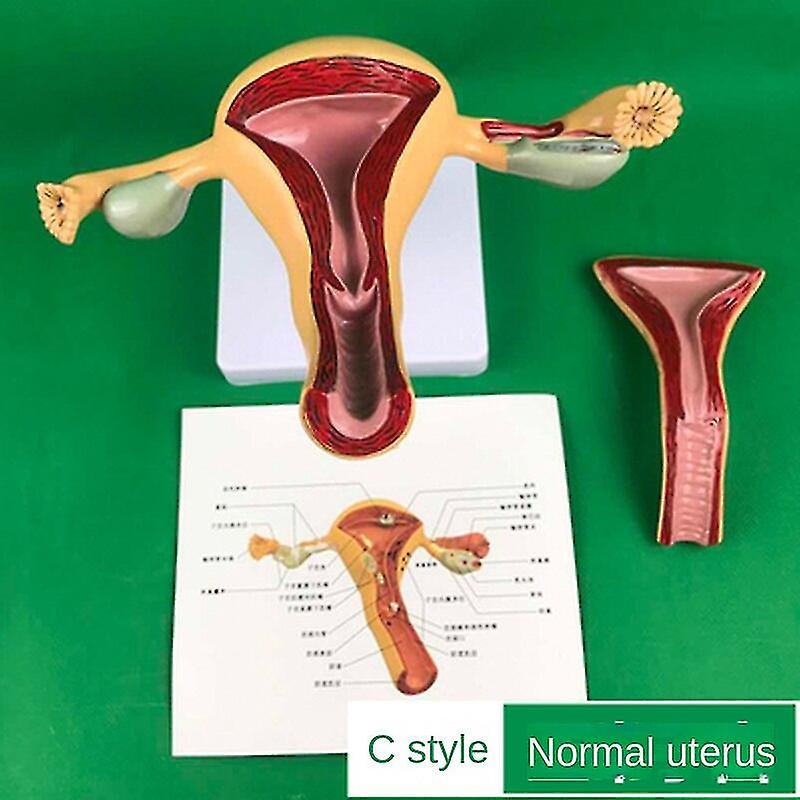 Ovary and uterus disease dissection model pathology female uterus model ...