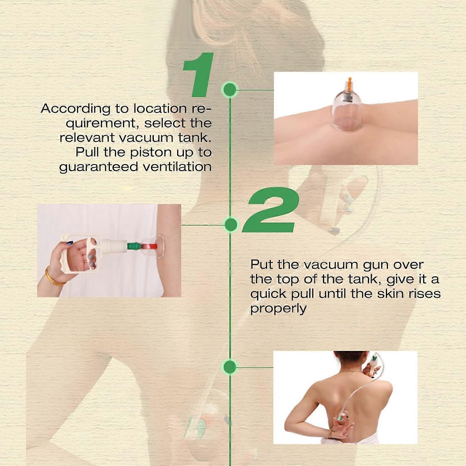 Chinese Medical Cupping Sets Device, Set Vacuum Air Suction Massage Cup ...