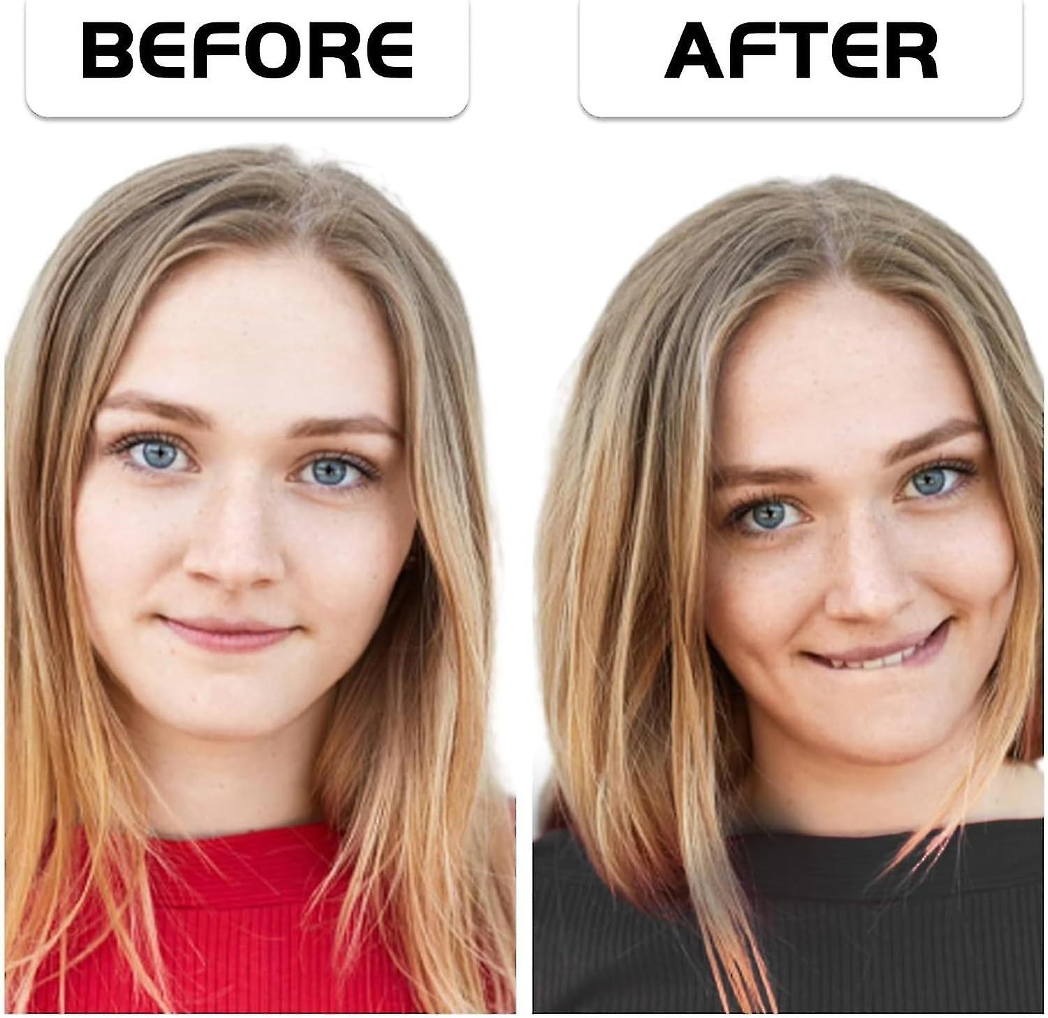 2pairs Dimple Makers - Dimple Trainer For The Face,natural Smile ...