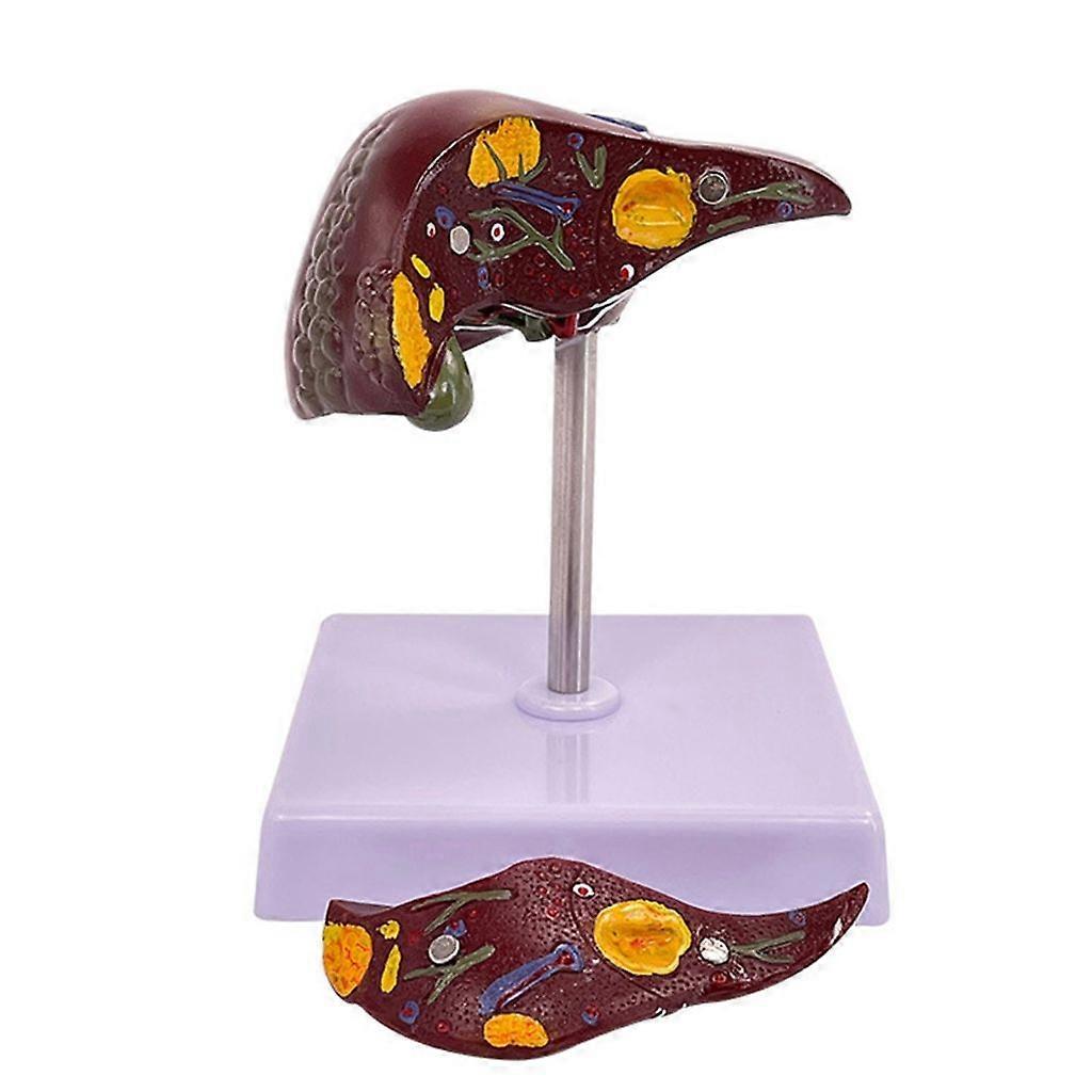 Gallbladder Model Life Size Human Stomach Gallbladder Pancreas Duodenum ...