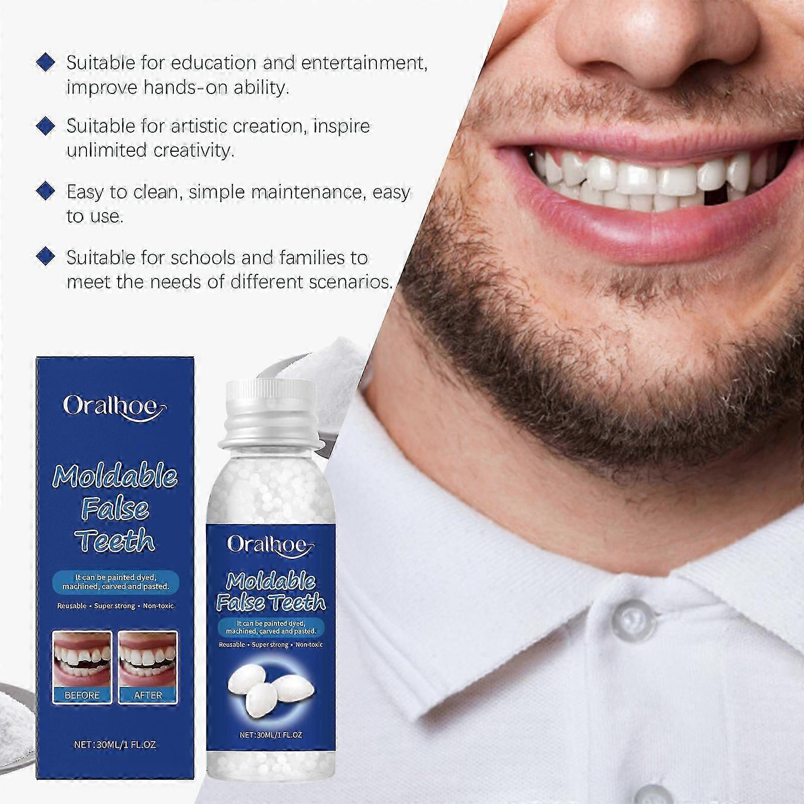 Tooth Repair Kit Temporary Tooth Filling Repair Beads Tooth Repair ...