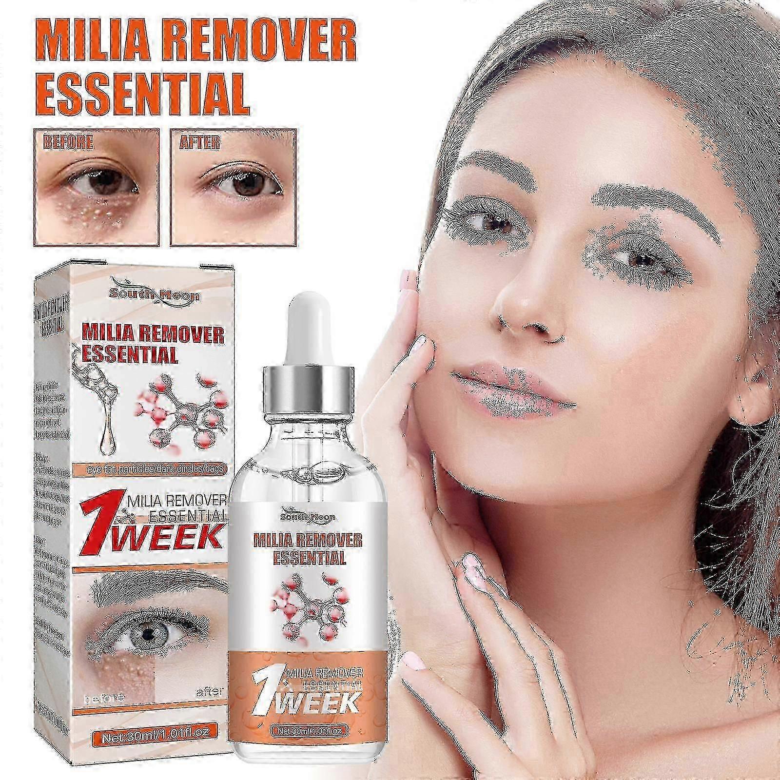 Speedy Milia Remover, Milia Remover Milia Spot Treatment, Speedy Milia ...