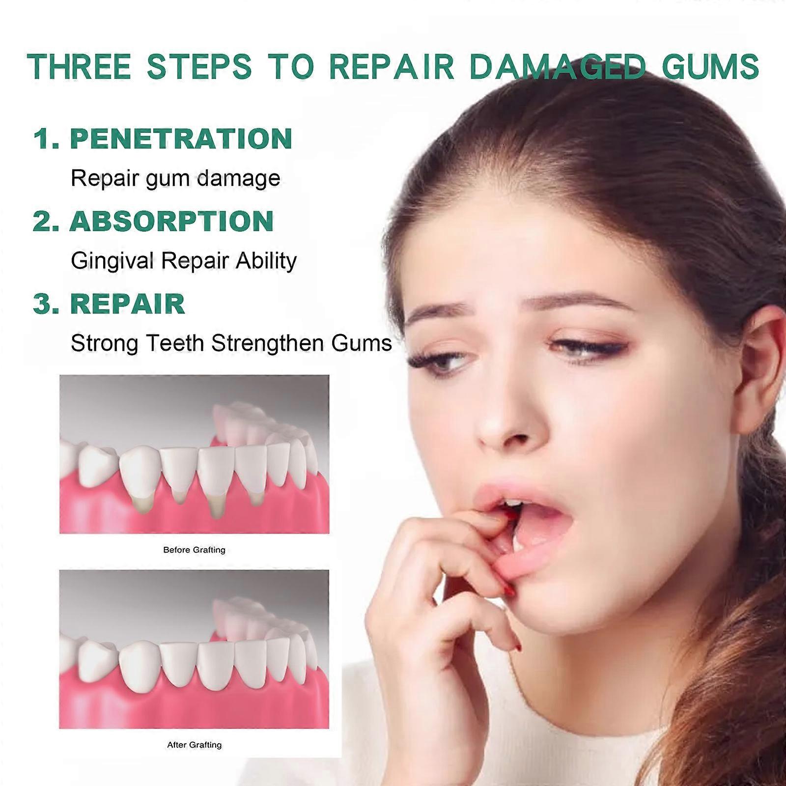 Gum Repair Drops Relieve Receding Gingival Swelling Gum Cleaning Care ...