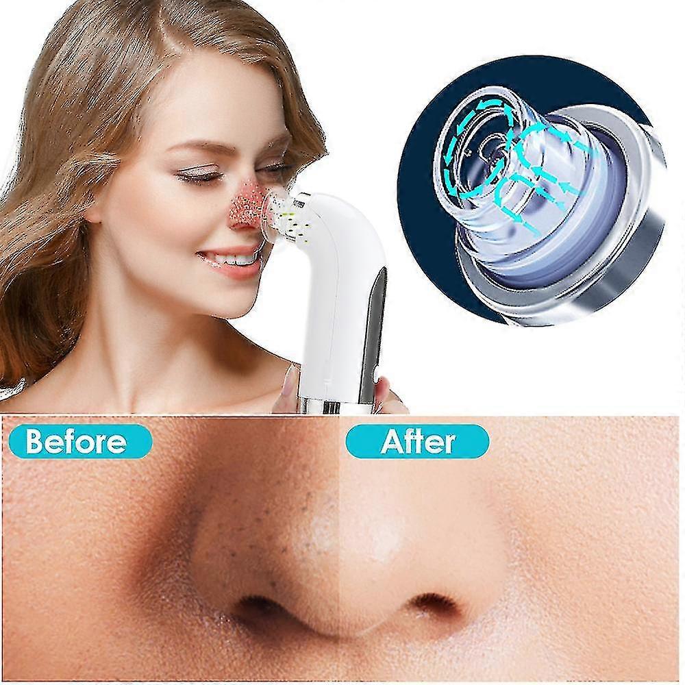 Blackhead Remover Pore Cleaner Vacuum Suction Acne Remover Pimple Black ...