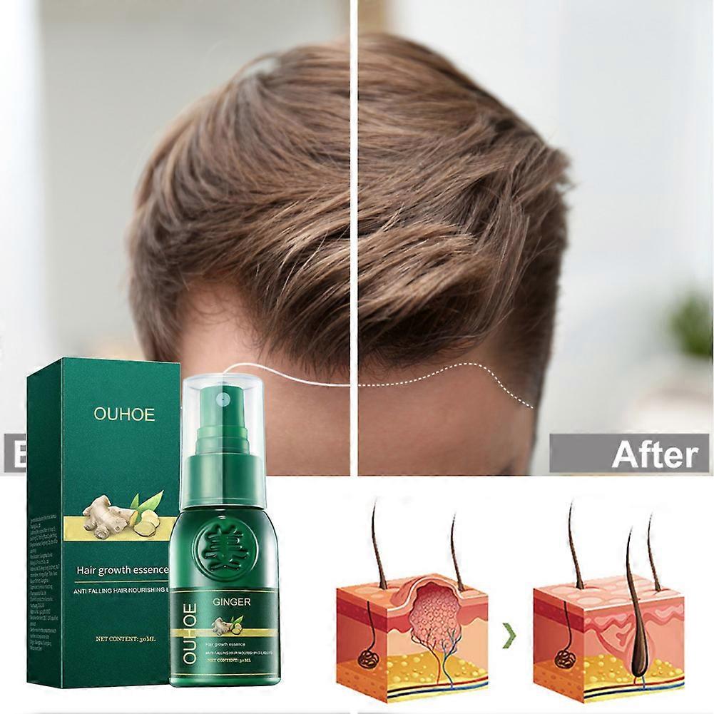 1-3pcs Hair Ginger Growth Products Ginger Fast Grow Oil Anti Hair Loss ...