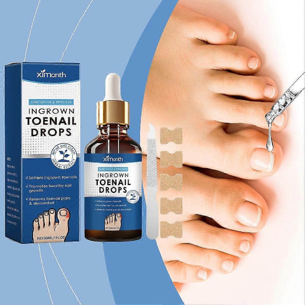 Ingrown Toenail Treatment. Ingrown Nail Repair Serum | Fruugo UK