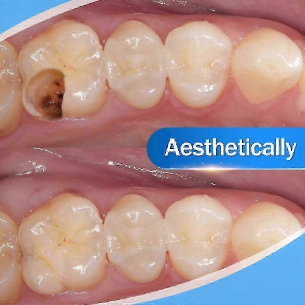 resin tooth repair cement for cavity filling | Fruugo AU