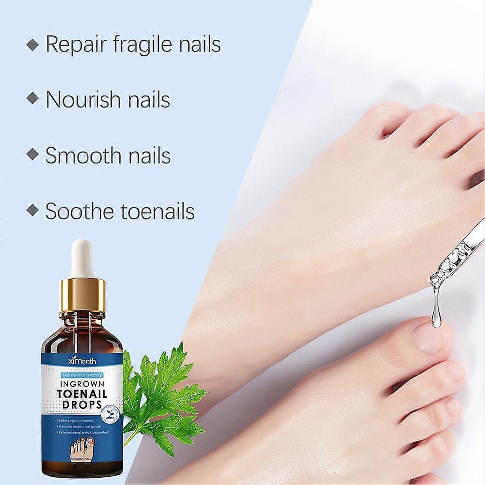 Ingrown Toenail Treatment. Ingrown Nail Repair Serum | Fruugo UK