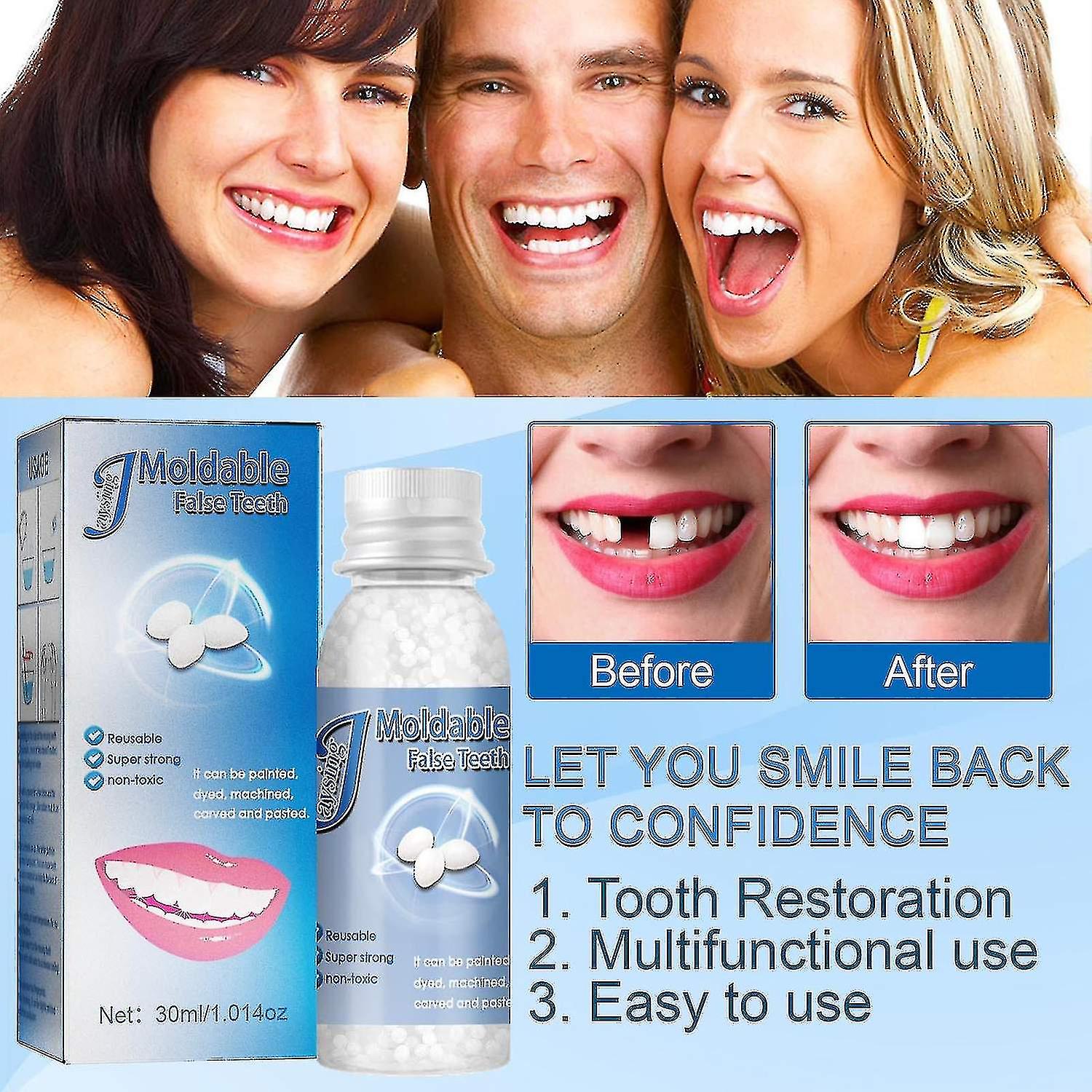 Teeth Repair Kit Temporary Teeth Replacement Kit Moldable False Teeth ...