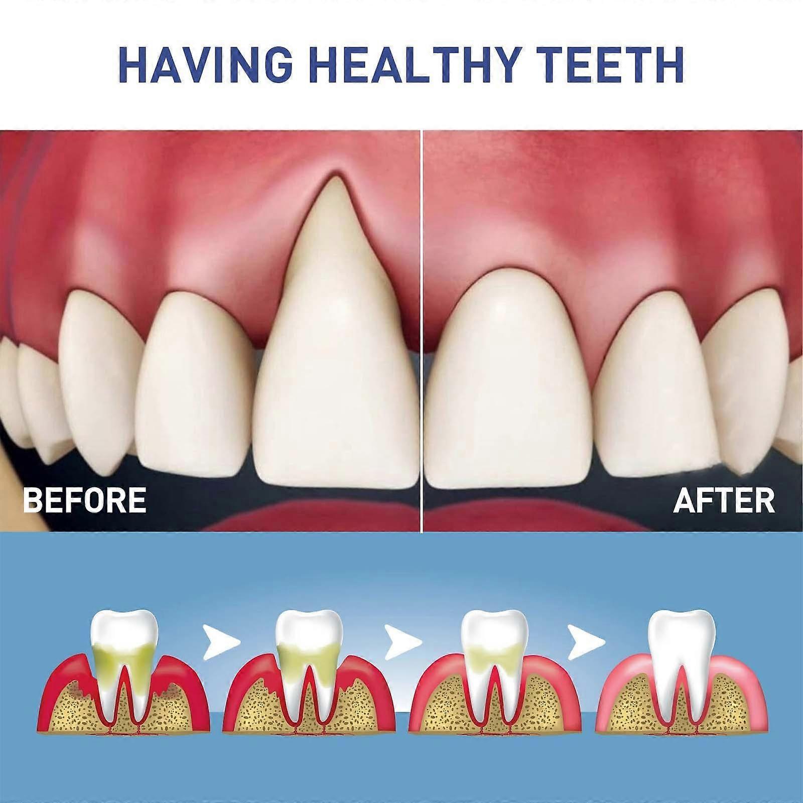 Toothpaste Gel Improves Oral Health And Reduces Sensitivity 4ml | Fruugo UK