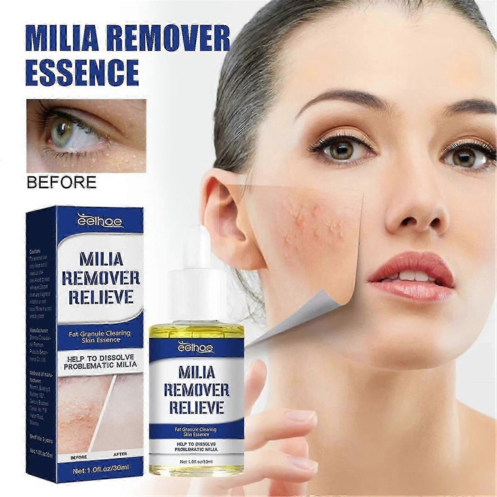 Milia Remover, Milia For Eye, Milia, Sebaceous 30ml | Fruugo UK
