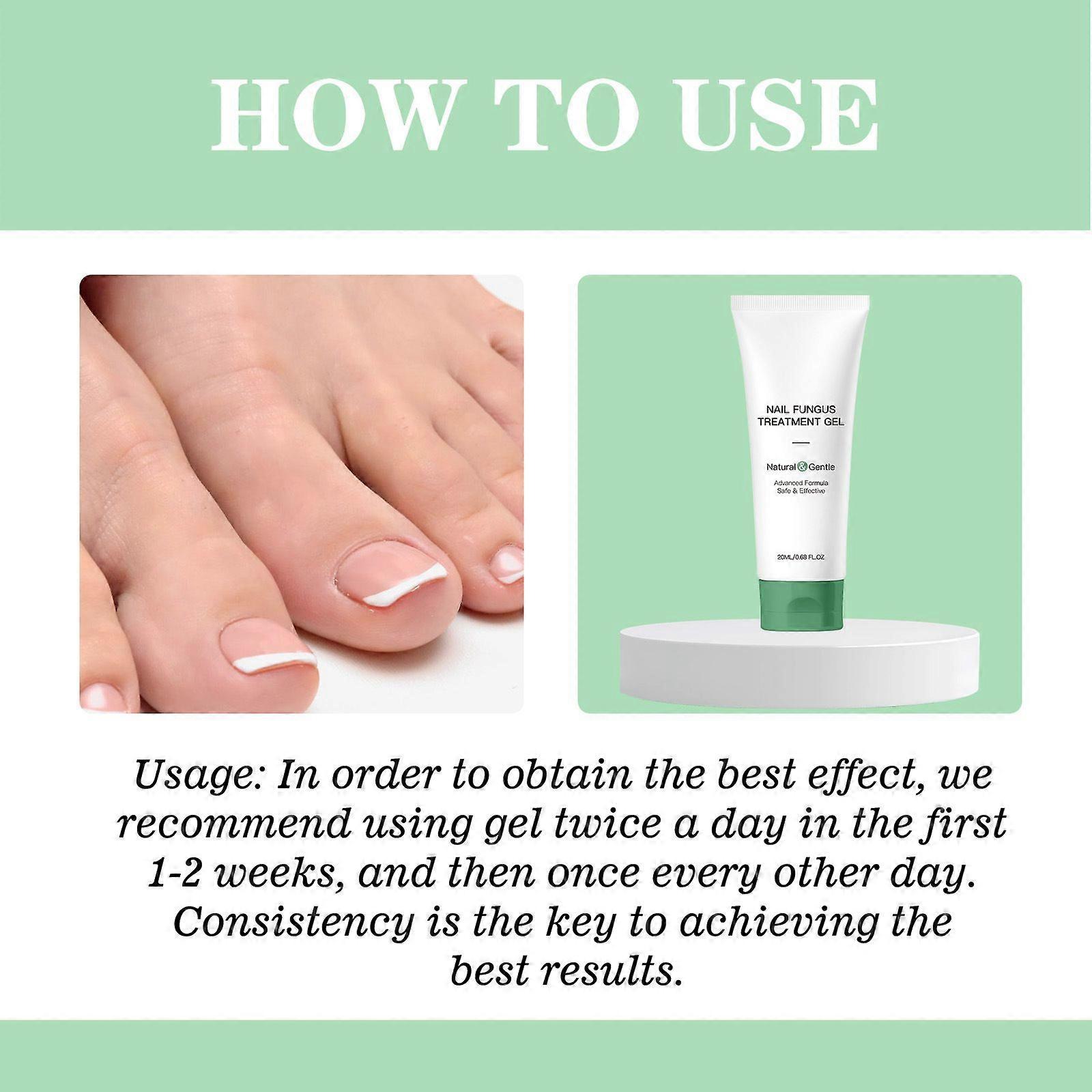 20ML Nutraboost Nail Fungus Treatment Gel, Natural Nail Repair ...