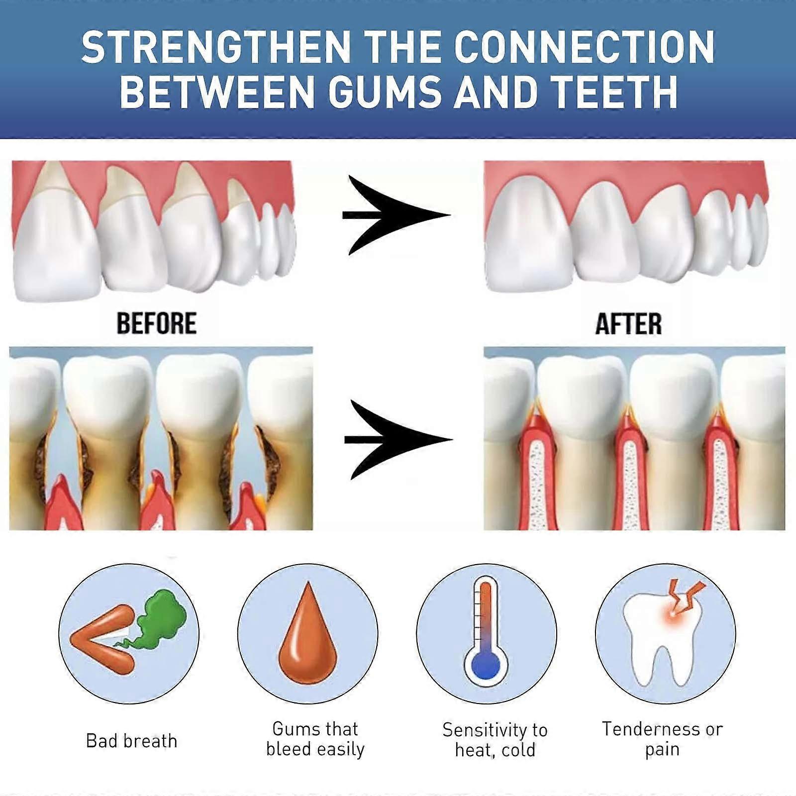 Toothpaste Gel Improves Oral Health And Reduces Sensitivity 4ml | Fruugo UK