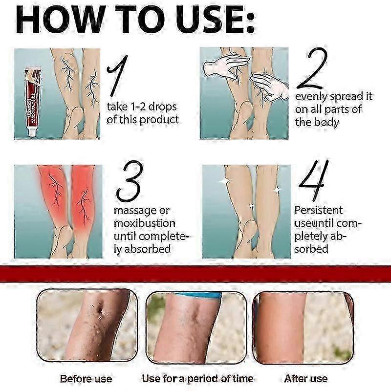 Vein Massage Qu Zhang Cream Relieve Leg Vascular Bulge Calf Swelling ...