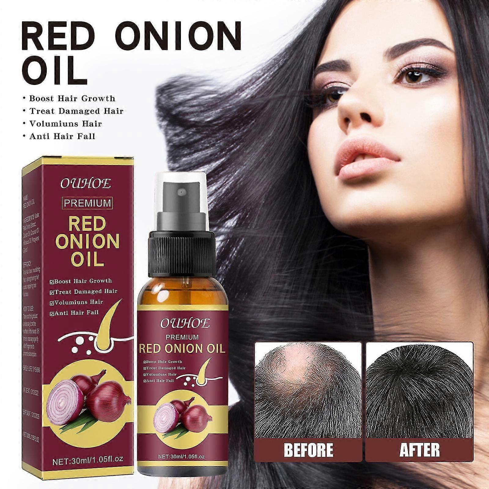 Red Onion Hair Oil,30ml Hair Growth Booster Increase Luster,Boost Hair ...