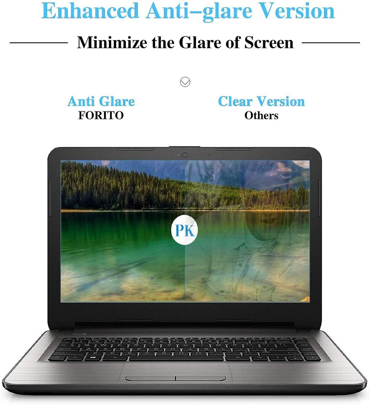 SBMLV-[2PCS Pack] 15.6-inch Laptop Crystal Clear Screen Protector ...