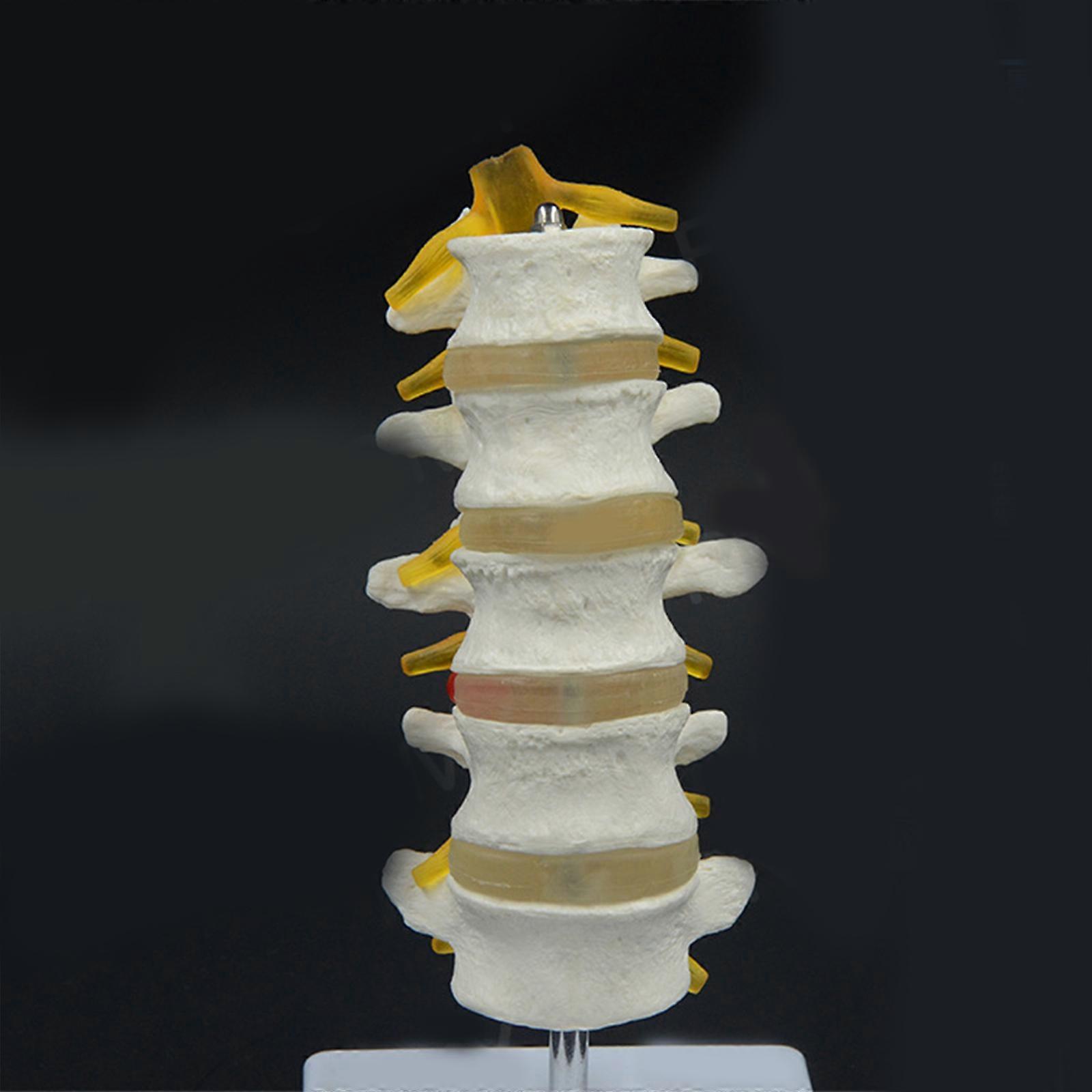 Five Segment Lumbar Spine Model Human Anatomical Lumbar Spine Model ...