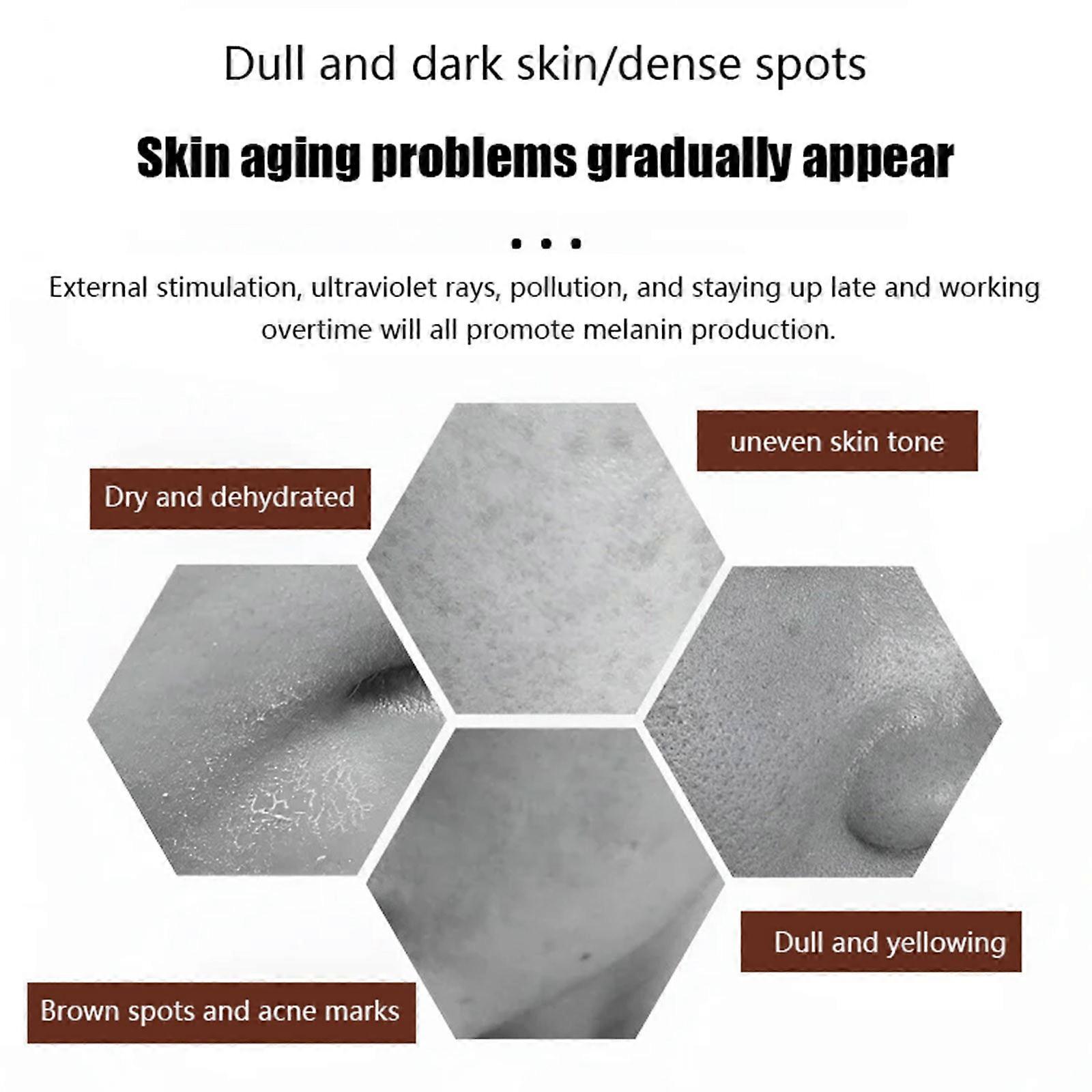 2024 New Antiaging Antiwrinkle Tear-Off Mask Freckle Removal Mask ...