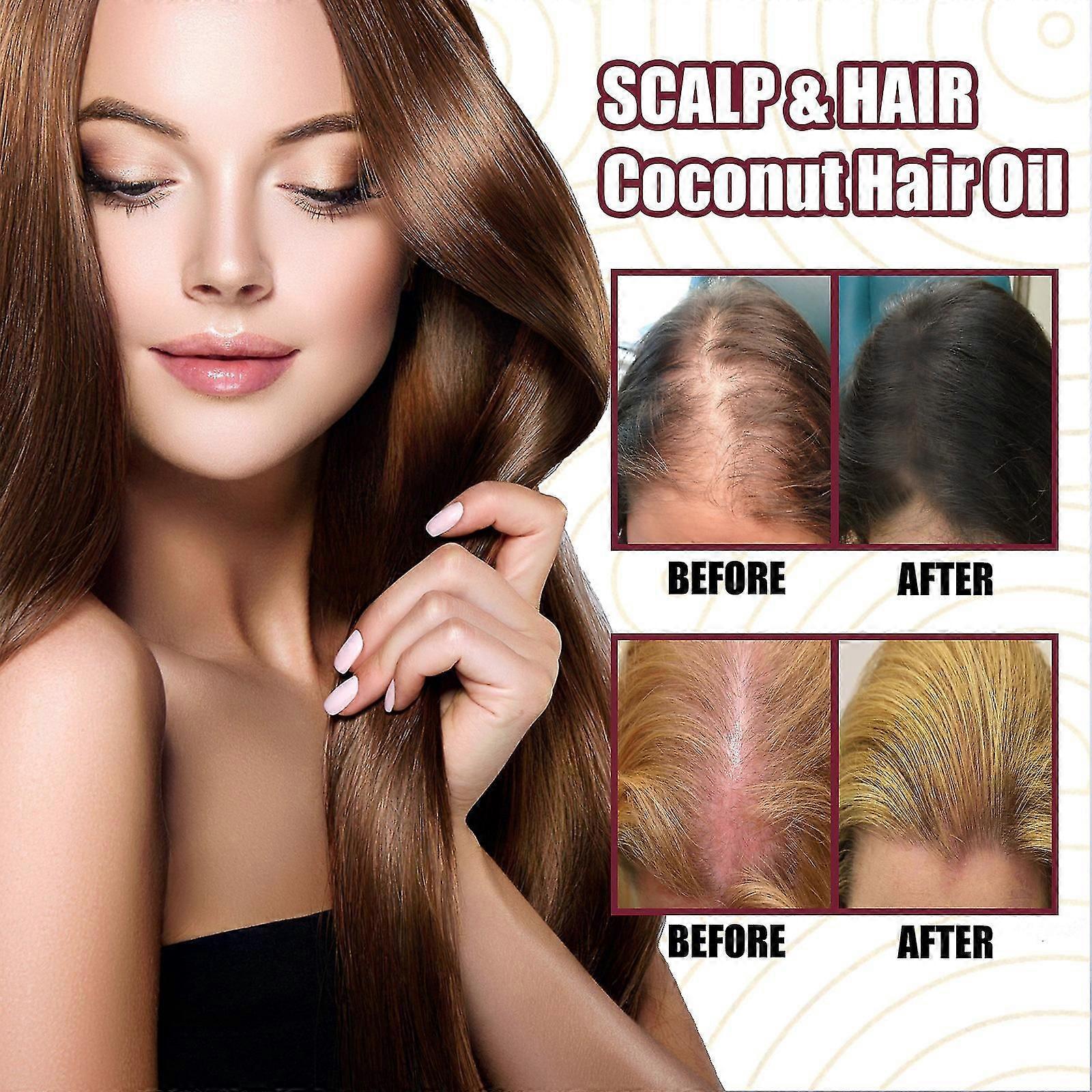 Red Onion Hair Oil,30ml Hair Growth Booster Increase Luster,Boost Hair ...