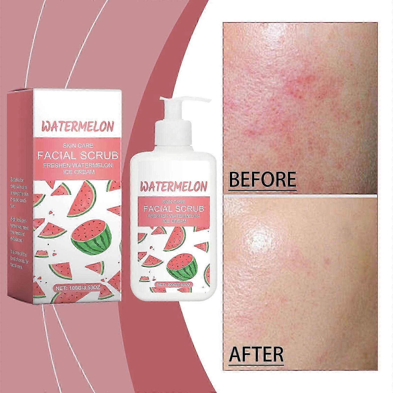 Watermelon Facial Scrub Sweet Watermelon Ice Cream Suitable For Deep ...