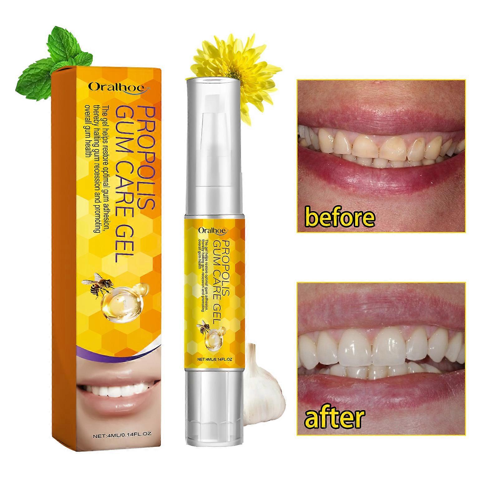 Propolis Gum Care Gel, Propolis Oral Gum Repair Gel, Propolis Teeth ...