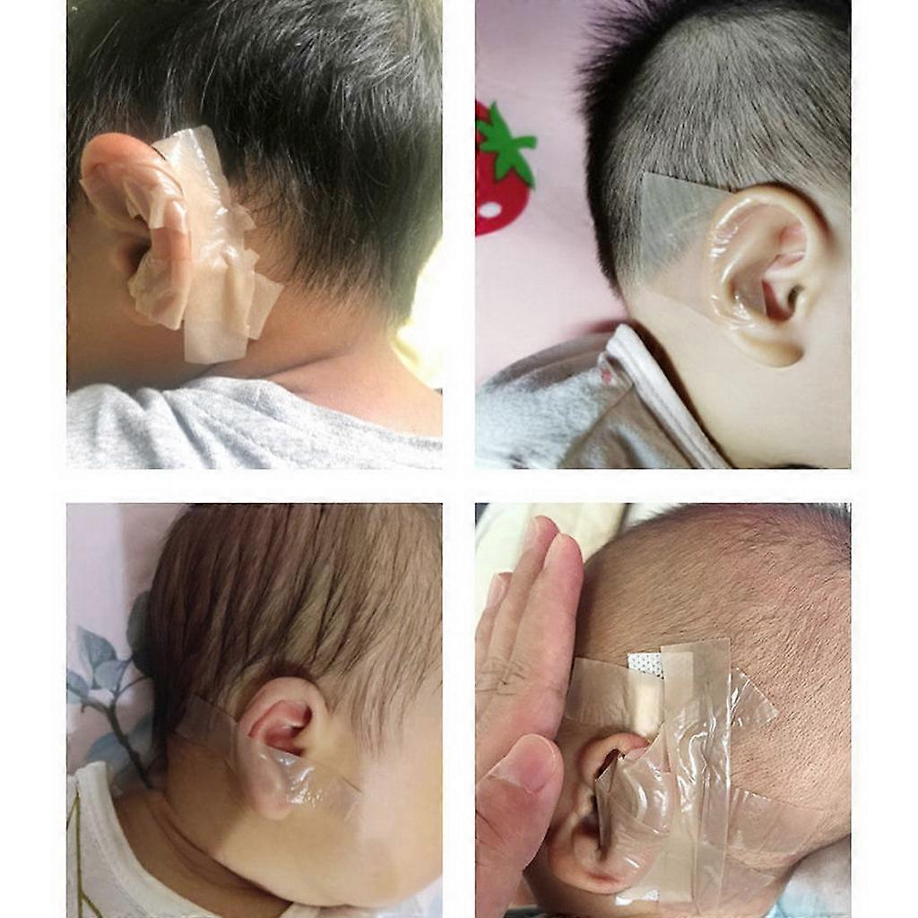 Baby Ear Corrector Sticker for Protruding Ear Silicone for Adults ...