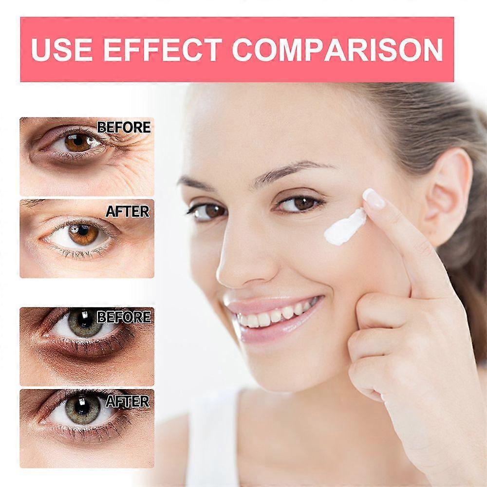 2PCS Retinol Eye Cream Stick Instant Eye Repair Serum Brightening Eye Cream Reduces Fine Lines ...