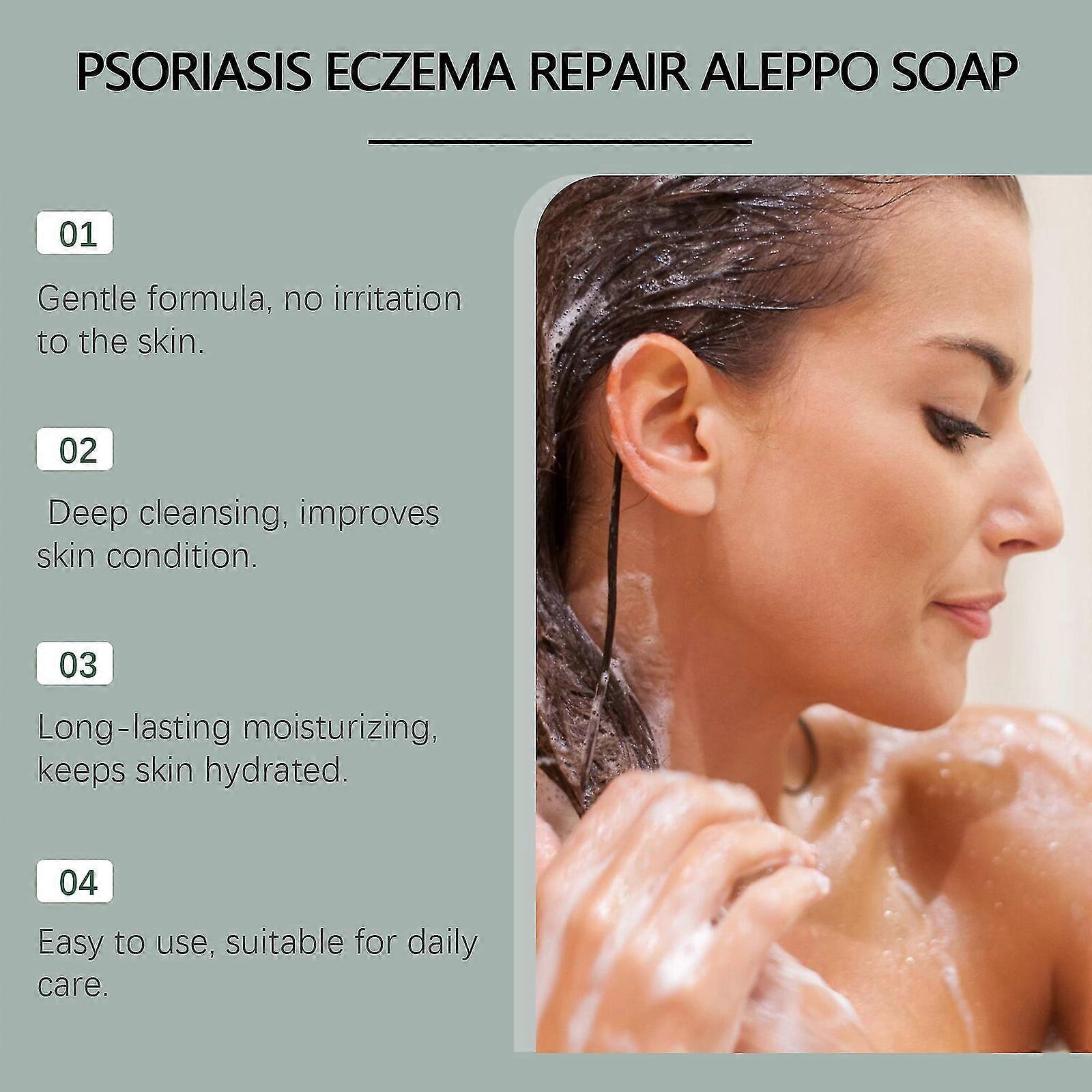 Psoriasis Soap, Psoriasis & Eczema Soap Bar for Face and Body, All ...