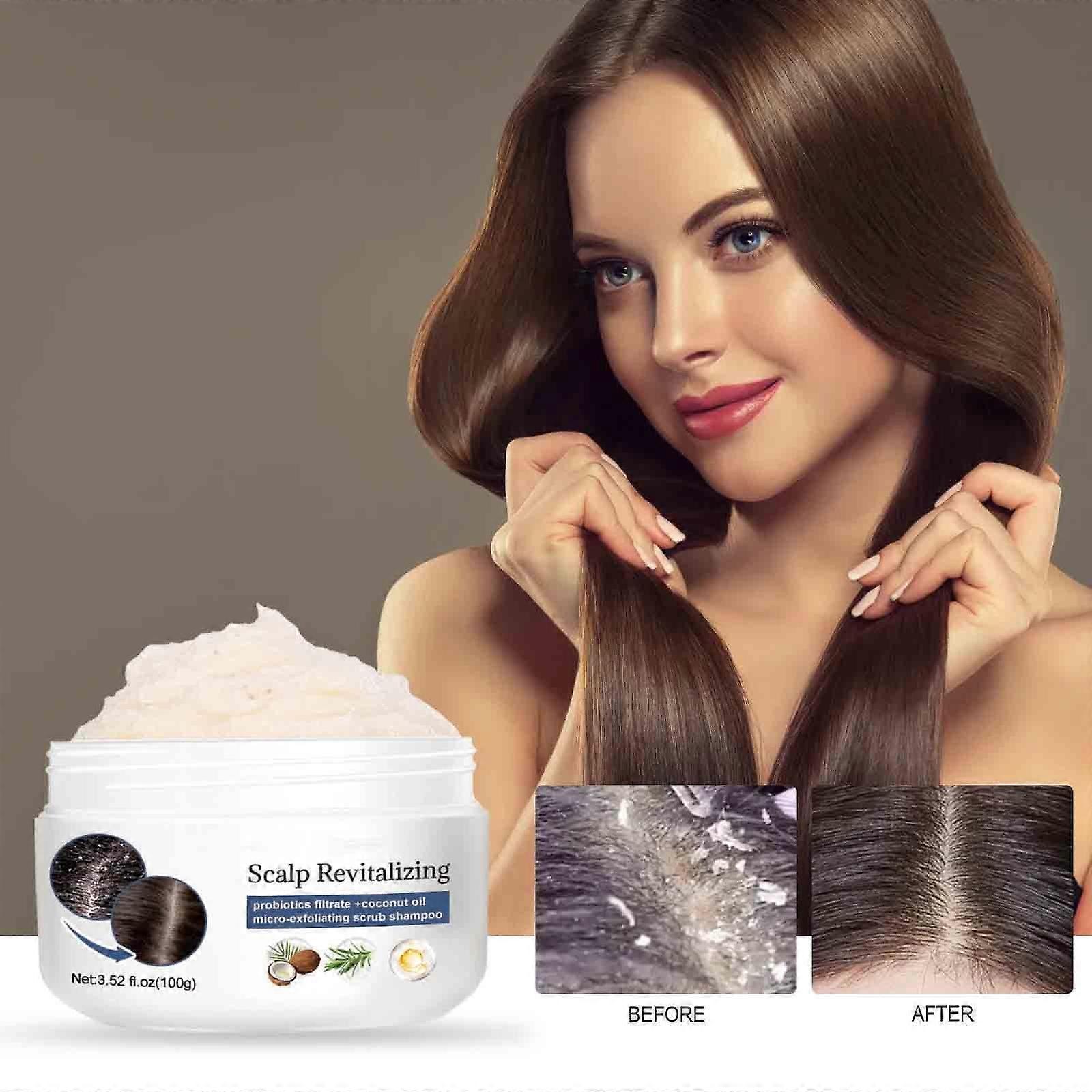 Sulfur Shampoo For Removing Lice, Relieving Itching, Controlling Oil ...