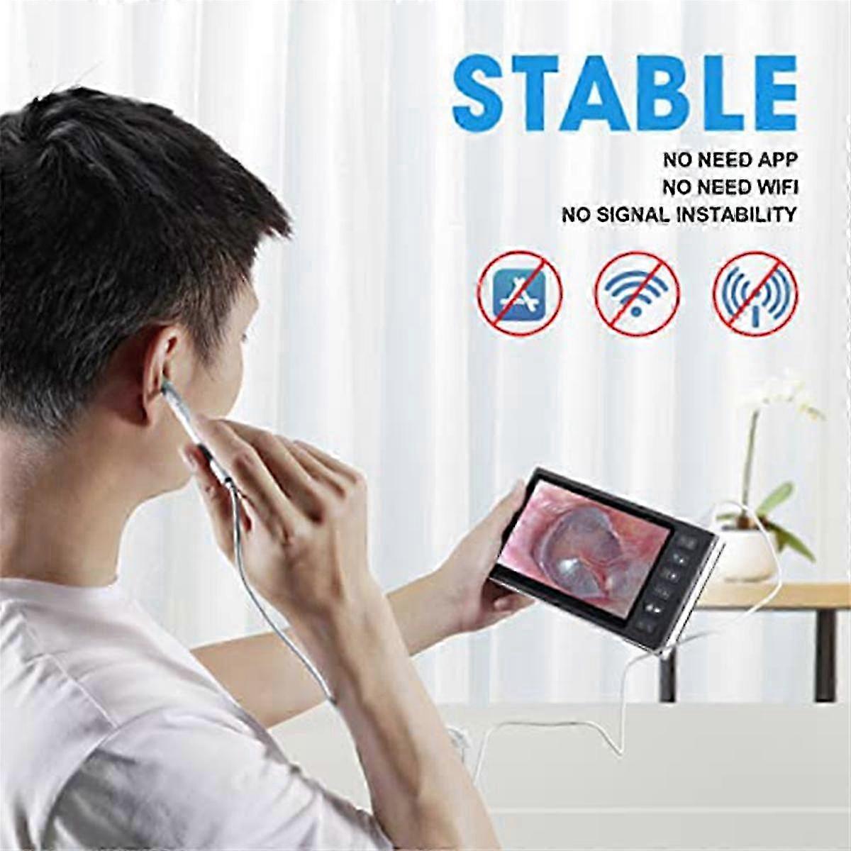 Digital Otoscope with 7-Inch Screen, Ear Camera, Visual Ear Scoop ...