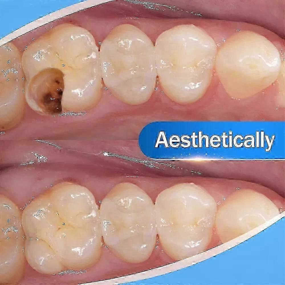 Teeth Resin Tooth Repair Dental Cement Cavity Filling Strong Repair ...