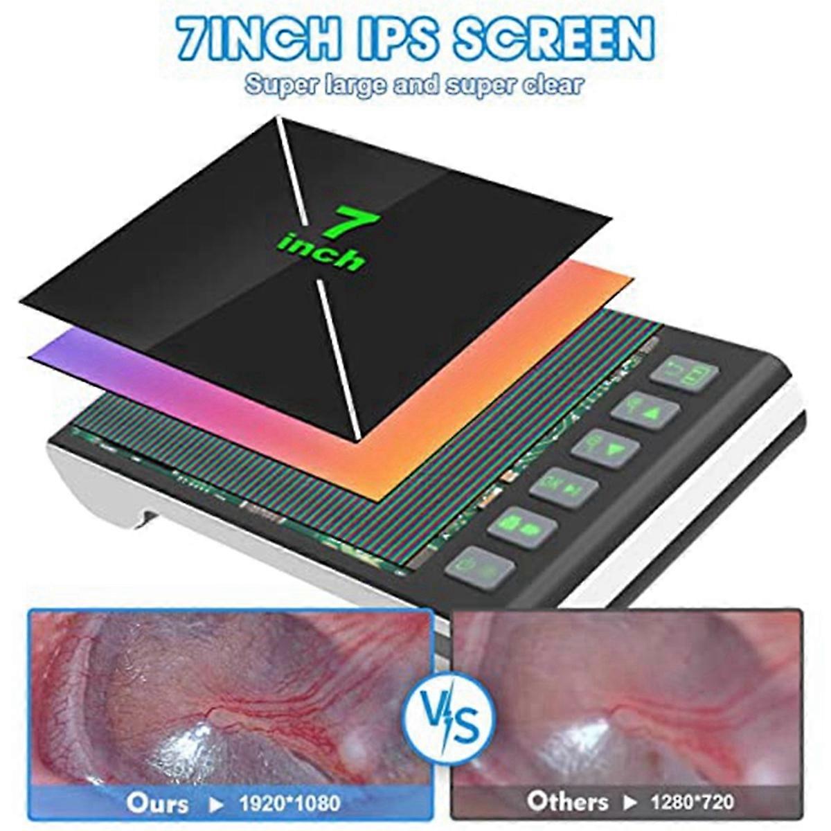 Digital Otoscope with 7-Inch Screen, Ear Camera, Visual Ear Scoop ...