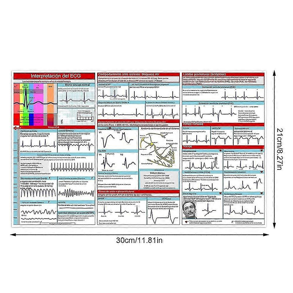 EKG Pocket Guide 3-in-1 Cardiac Reference for Nurses EMTs, Rapid ...