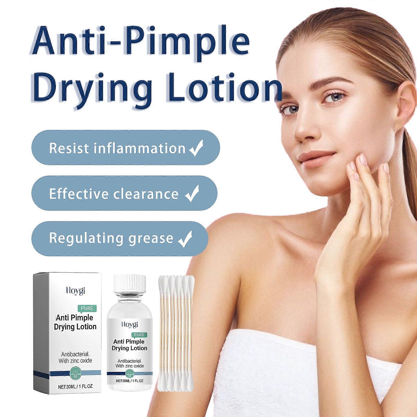 Anti-Pimple Drying Lotion, Facial Cleansing And Repair Lighten Acne ...